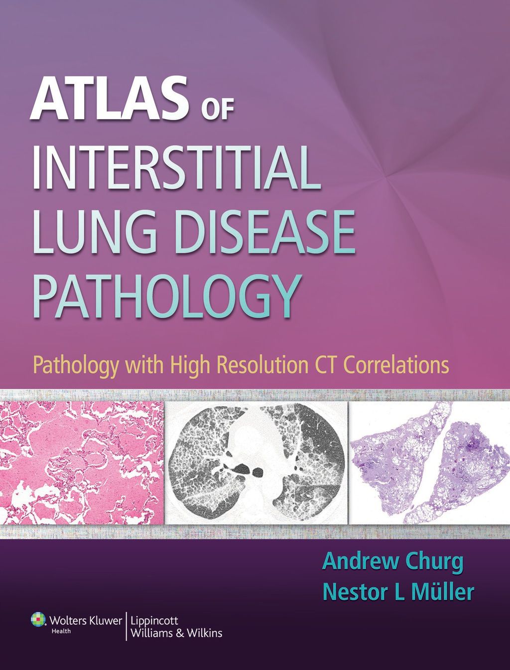 Atlas of Interstitial Lung Disease Pathology: Pathology with High ...