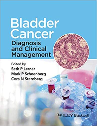 Bladder Cancer: Diagnosis and Clinical Management - Magictransferidea