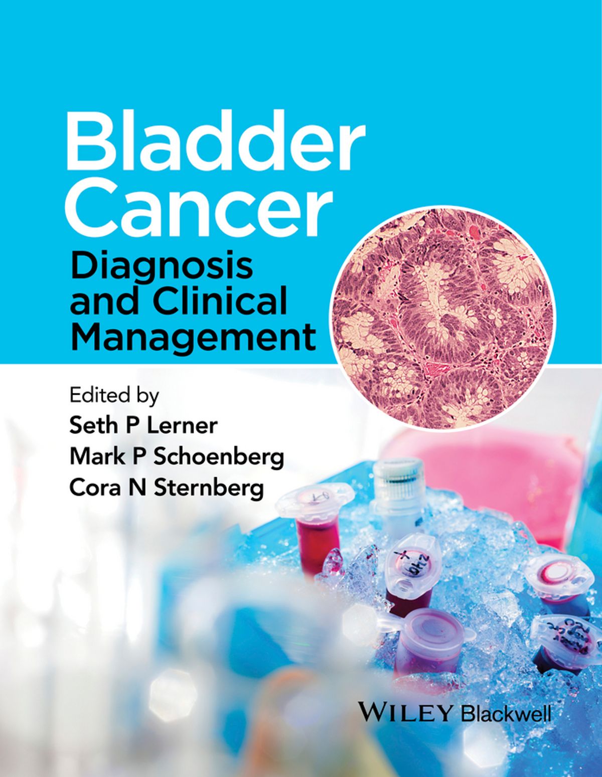 Bladder Cancer: Diagnosis and Clinical Management - Magictransferidea