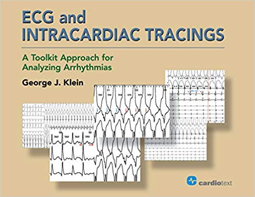 ECG and Intracardiac Tracings: A Toolkit Approach for Analyzing ...
